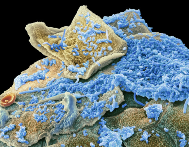 Bacterias En La Boca Bajo El Microscopio Prueba De Sífilis